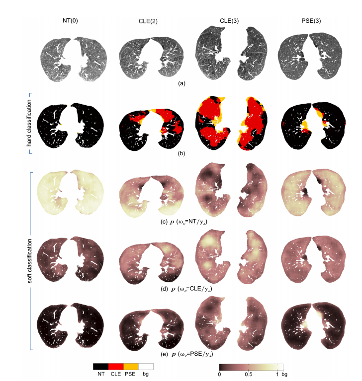 COPD Image Analysis